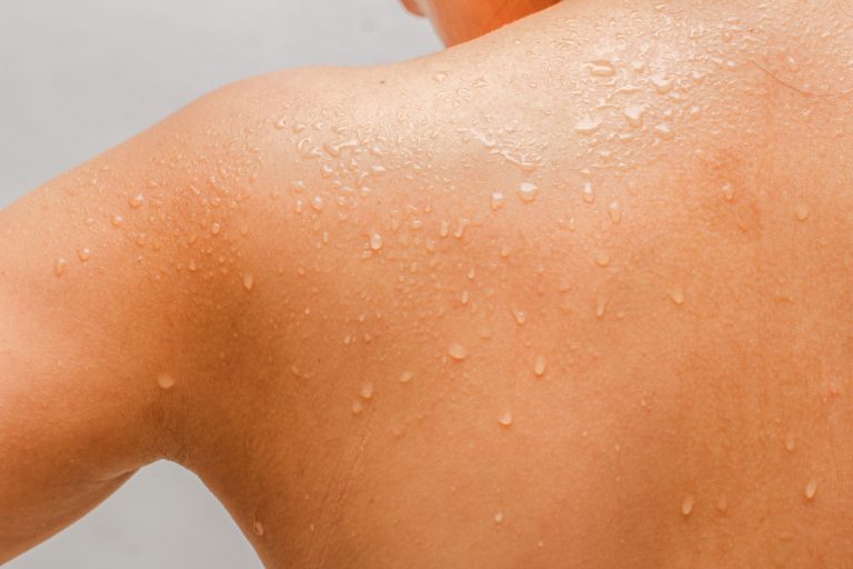 Chromhidrosis: Obat, Penyebab, Gejala, dll. - Hello Sehat