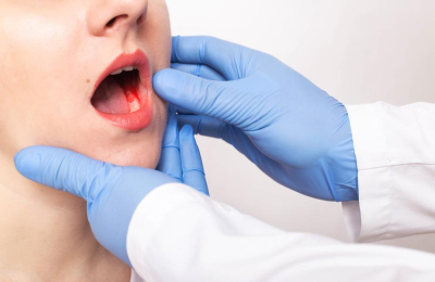 Tumor Rahang: Obat, Penyebab, Gejala, dll. - Hello Sehat