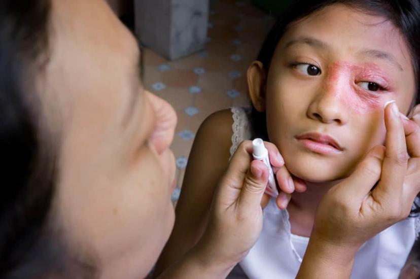 Oksitetrasiklin: Kegunaan, Dosis, dan Efek Samping - Hello Sehat