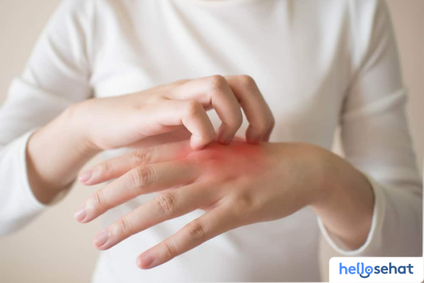 Isothipendyl: Kegunaan, Dosis, Efek Samping, Cara Pakai • Hello Sehat