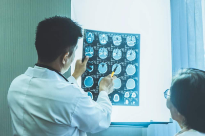 Apakah Operasi Stroke Efektif Menyembuhkan Stroke? • Hello Sehat