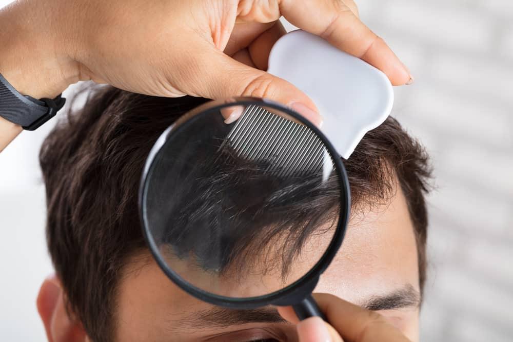 Kutu Rambut: Gejala, Penyebab, Pengobatan, dll. - Hello Sehat