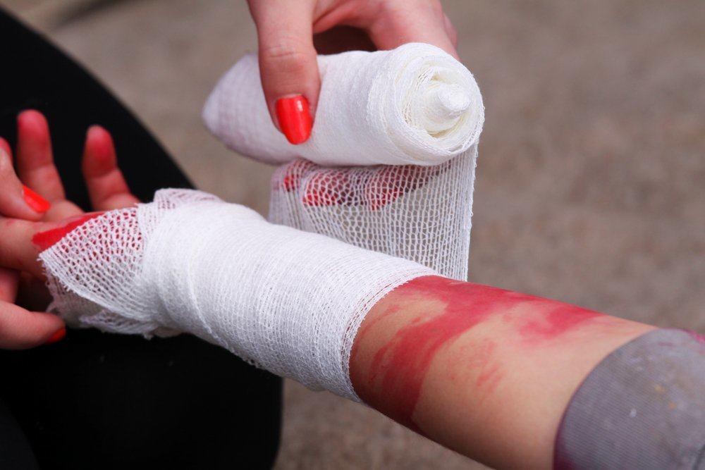 3 Jenis Perdarahan Luar dan Penanganan yang Tepat - Hello Sehat