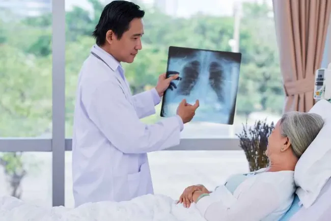 Mengenal Pneumokokus, Bakteri Penyebab Pneumonia