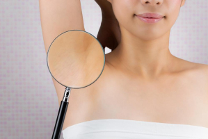 7 Cara Putihkan Ketiak yang Hitam dengan Bahan Alami di Rumah • Hello Sehat