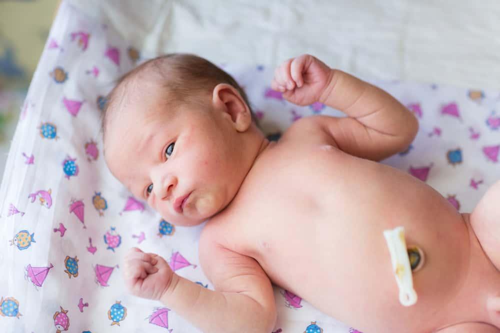 Pusar Bodong pada Bayi, Apakah Bisa Diperbaiki?