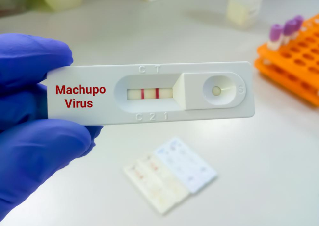 Paracetamol Mengandung Virus Machupo: Hoax atau Fakta? - Hello Sehat