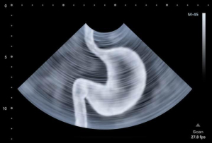 Anatomi dan Fungsi Lambung Manusia - Hello Sehat