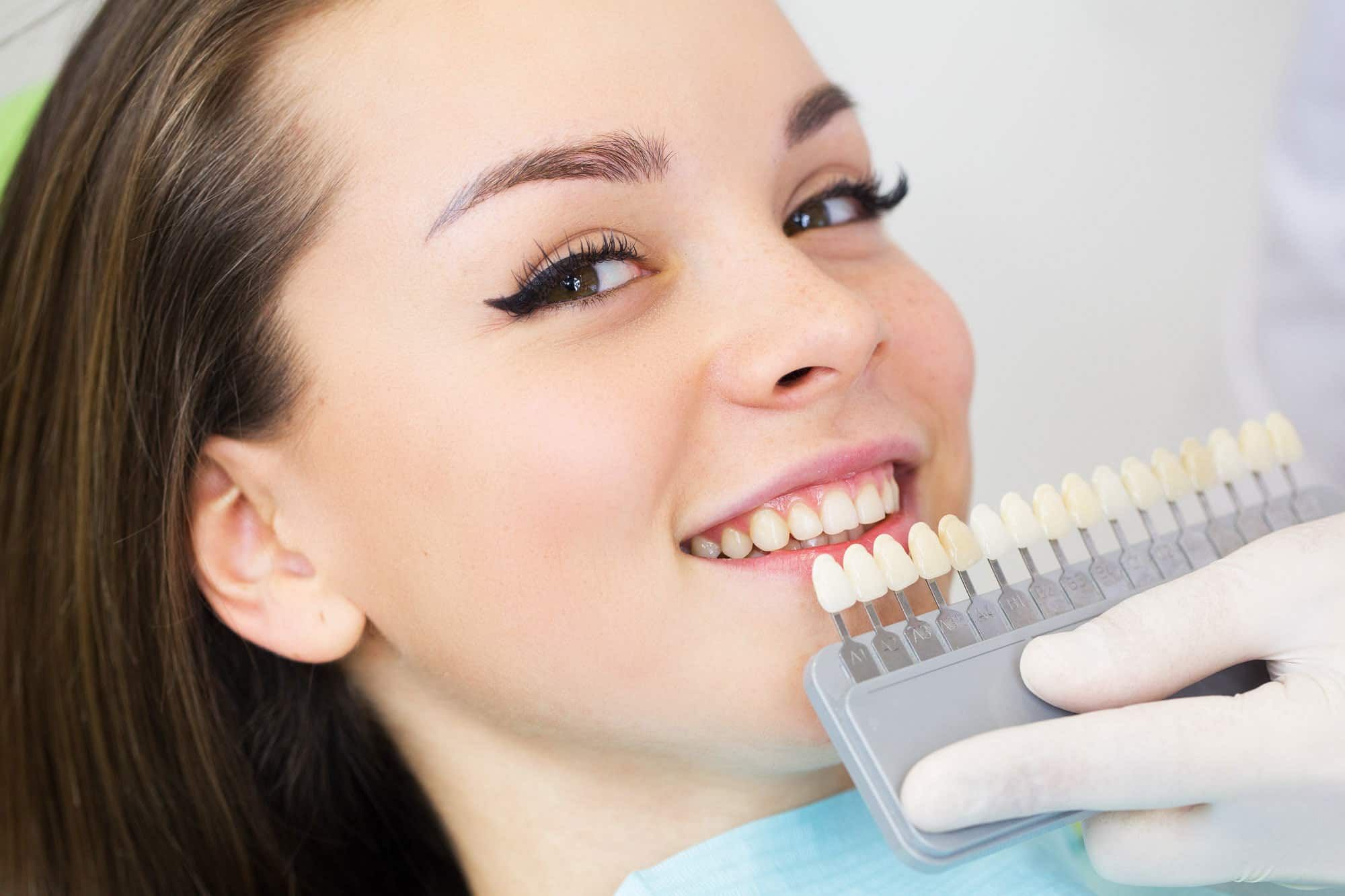 Veneer Gigi: Definisi, Tujuan, Prosedur, dll. - Hello Sehat