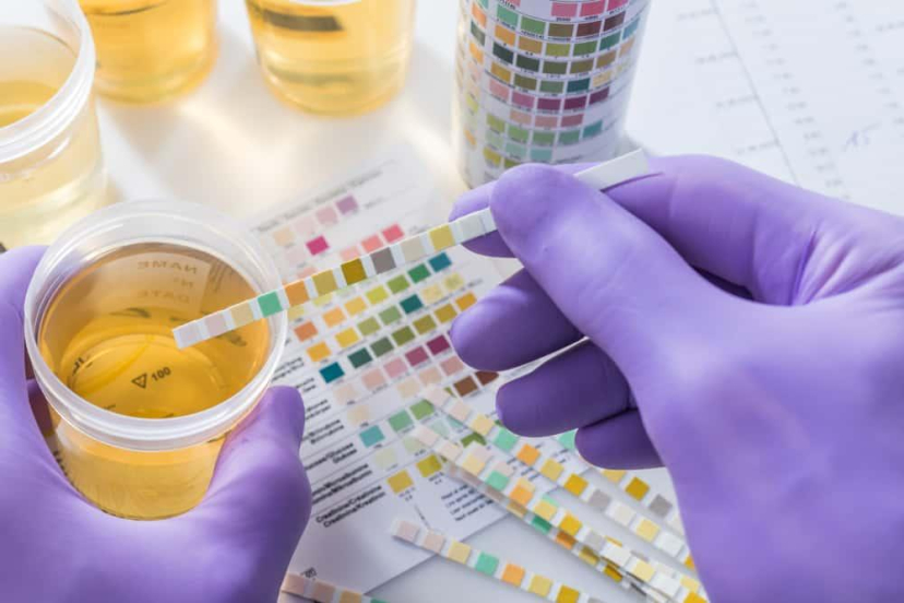 Ciri Urine Normal dari Warna, Bau, dan Jumlahnya