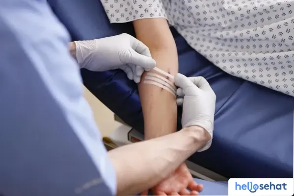 Kapan Waktu Ideal Melepas Jahitan Luka Operasi?