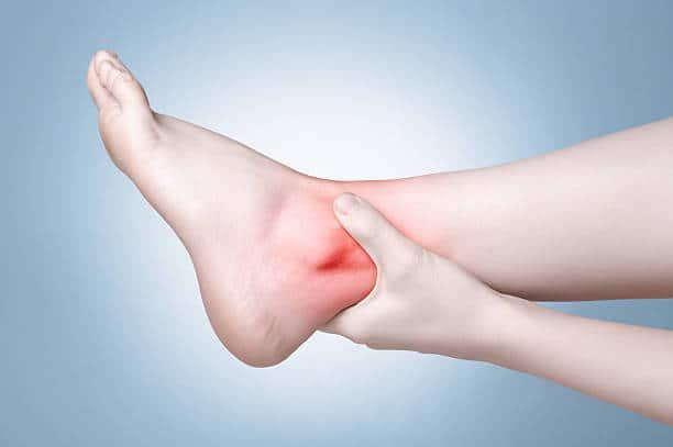 Chronic Venous Insufficiency (CVI): Gejala Hingga Pengobatan