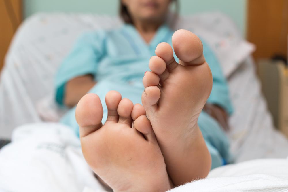 Ulkus Dekubitus (Luka Baring): Gejala, Penyebab, dan Obat