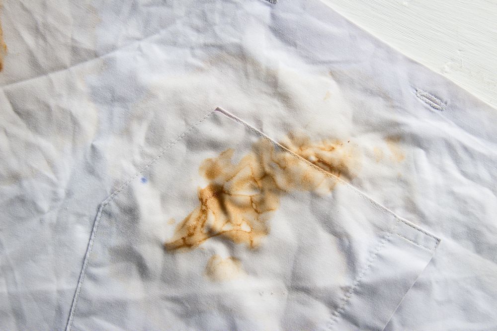 Bercak Kuning di Celana Dalam, Apakah Ini Normal?