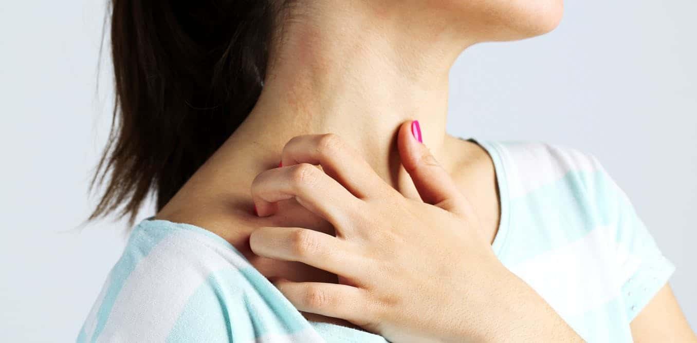 7 Pantangan Scabies agar Tidak Semakin Parah - Hello Sehat