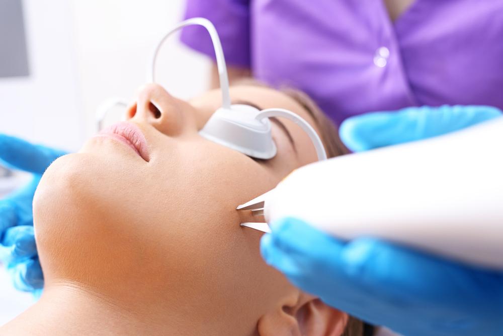 Memutihkan Wajah Dengan Laser, Benarkah Efektif?