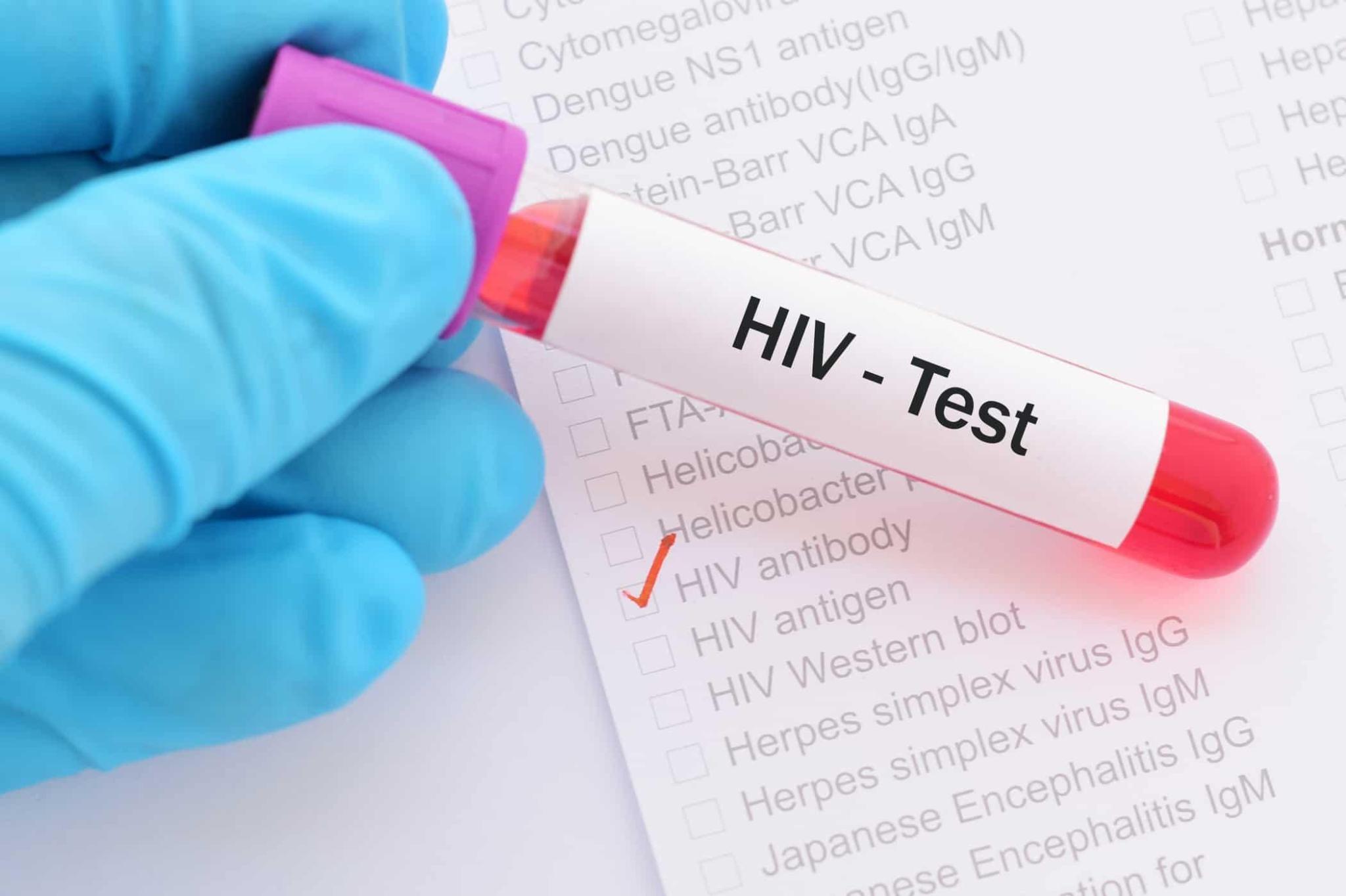 4 Jenis Tes HIV yang Umum dan Pemeriksaan Lanjutannya