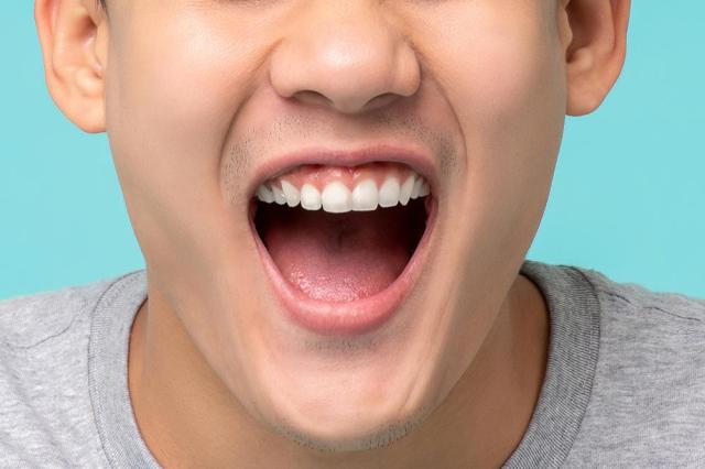 Anatomi Mulut Manusia, Bagian, dan Fungsi Lengkap - Hello Sehat