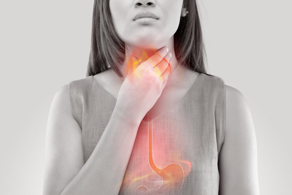Laryngopharyngeal Reflux (LPR): Gejala, Penyebab, Obat, dll.