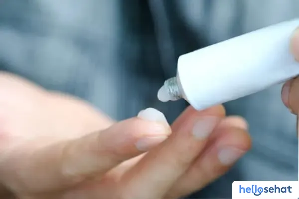 Daftar Obat Panu Paling Ampuh yang Mudah Didapatkan