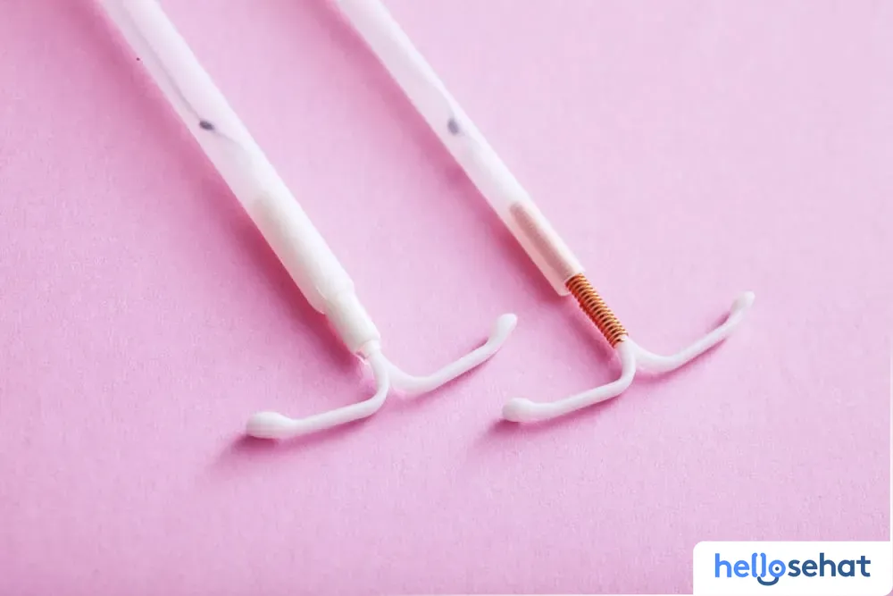 KB IUD: Cara Kerja, Keunggulan, dan Efek Samping
