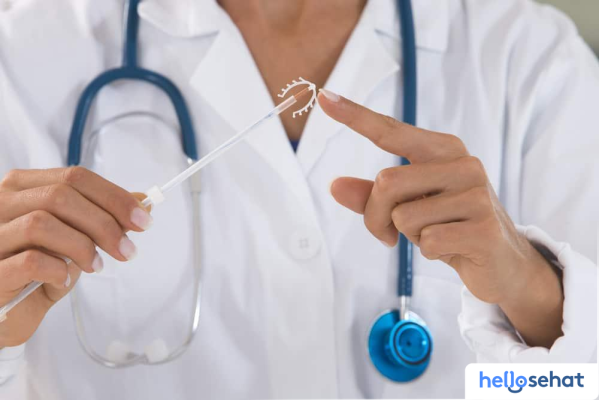 8 Efek Samping dari KB IUD yang Harus Dipertimbangkan