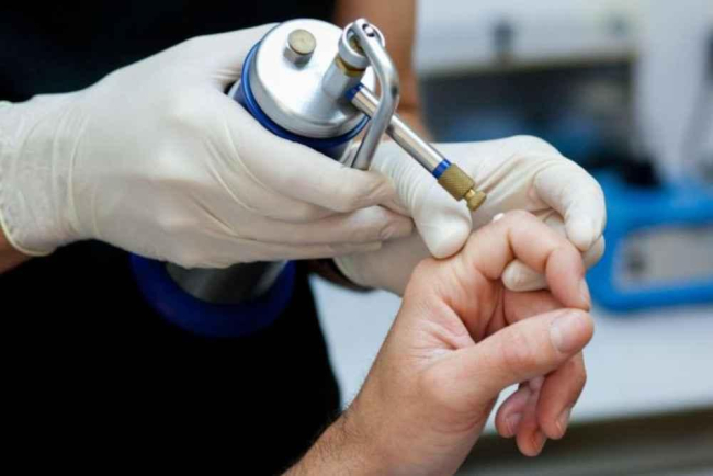 Manfaat Cryotherapy, Prosedur, dan Efek Sampingnya
