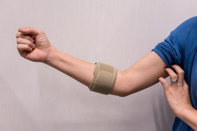 Siku Tangan Sakit Akibat Tennis Elbow? Ini Cara Mengatasinya!