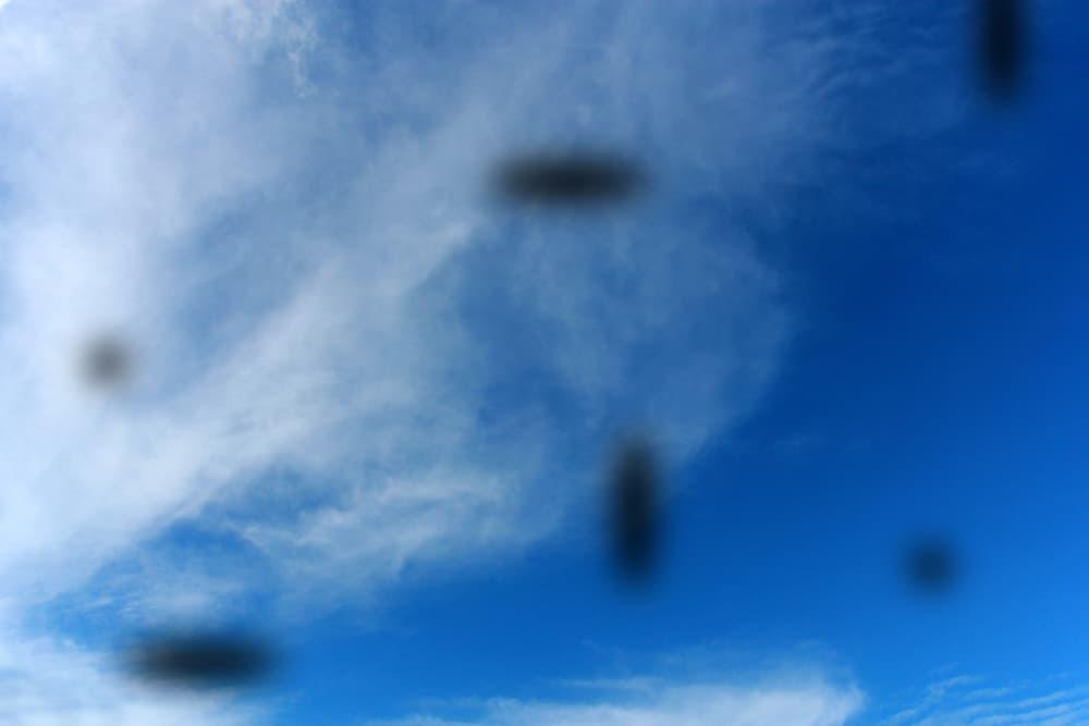 Floaters: Gejala, Penyebab, Pengobatan, dll - Hello Sehat