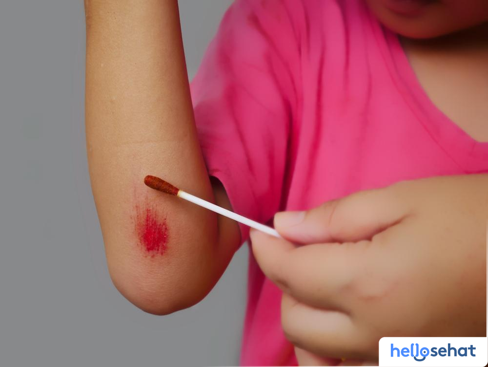 Perawatan Luka Secara Umum dan Sesuai Jenisnya | Hello Sehat