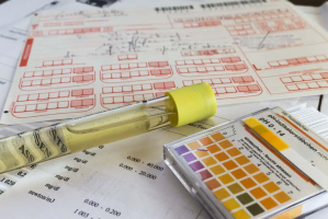 Tes Urine: Jenis, Fungsi, Prosedur, dan Hasil - Hello Sehat