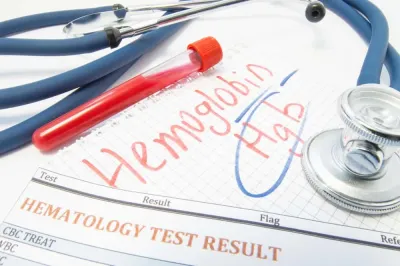 Fungsi Hemoglobin dan Kadar Normalnya dalam Tubuh | Hello Sehat