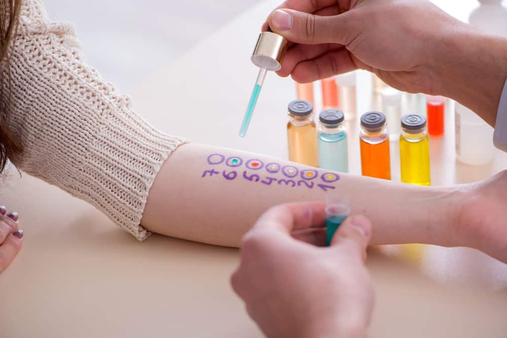 Tes Uji Tusuk Alergi (Skin Prick Test): Fungsi, Proses, dan Hasil