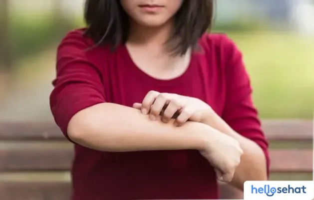 Travocort: Kegunaan, Dosis, Efek Samping, dll. • Hello Sehat