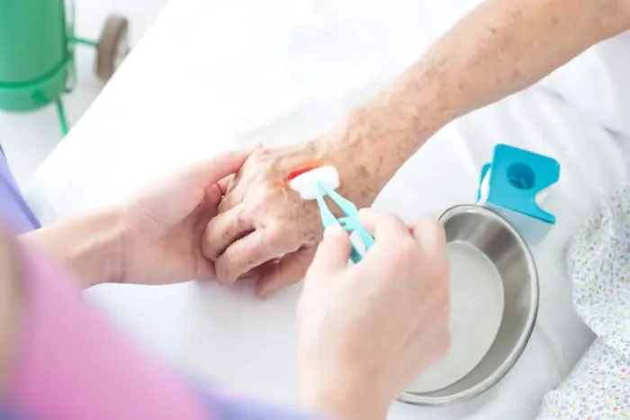 3 Tata Cara Membalut Luka Terbuka yang Cepat dan Tepat