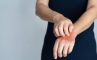 Macam-Macam Dermatitis yang Perlu Diketahui, Apa Perbedaannya?