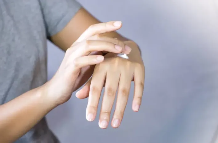 Kudis: Gejala, Penyebab, dan Pengobatan - Hello Sehat