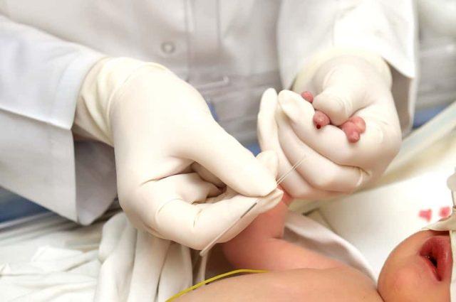 Leukosit Tinggi pada Anak: Gejala, Penyebab, Pengobatan, dll