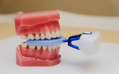 Gigi Gingsul Dicabut atau Dibiarkan? • Hello Sehat