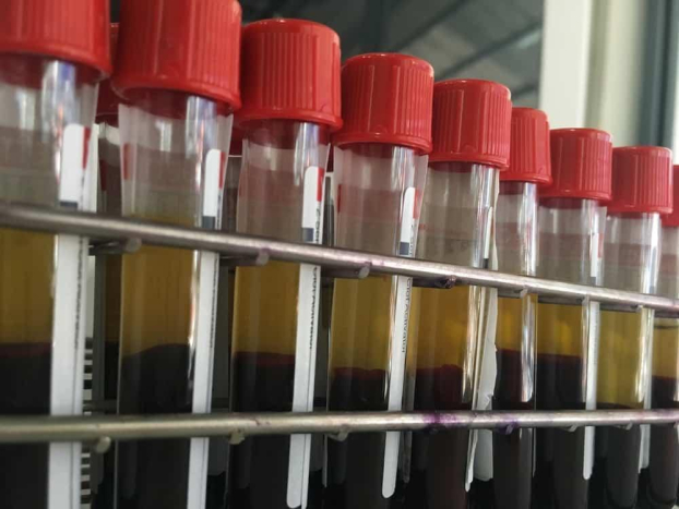 6 Fakta Unik Seputar Golongan Darah AB yang Perlu Anda Ketahui