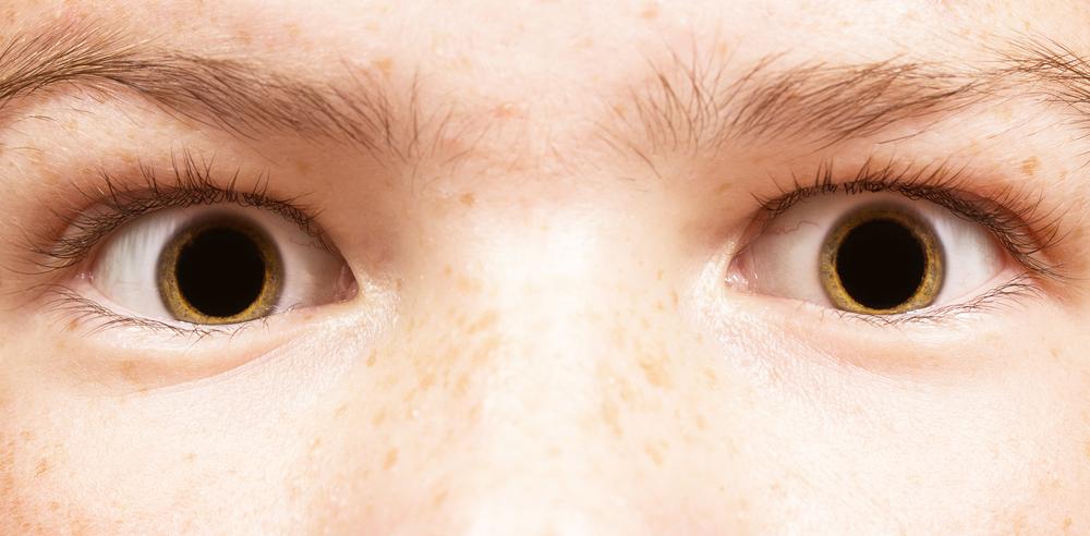 Midriasis, Saat Pupil Mata Tidak Melebar dengan Normal | Hello Sehat