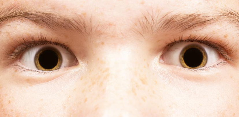 Midriasis, Saat Pupil Mata Tidak Melebar dengan Normal | Hello Sehat