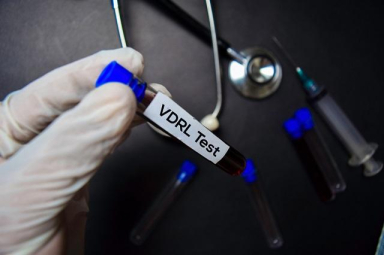 Tes VDRL untuk Deteksi Sifilis, Begini Prosedurnya