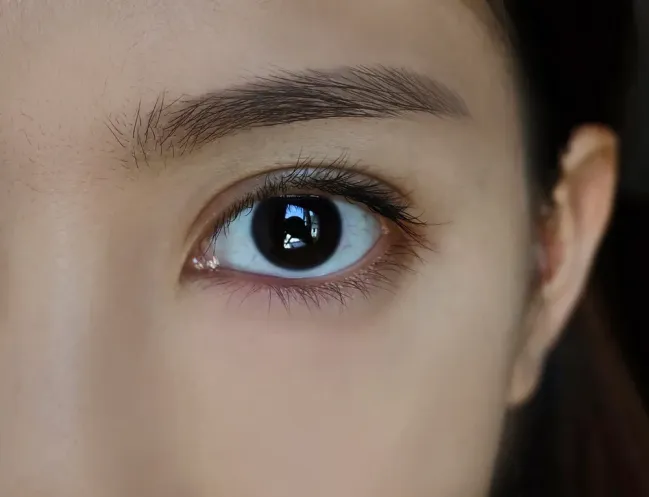 Midriasis, Saat Pupil Mata Tidak Melebar dengan Normal | Hello Sehat