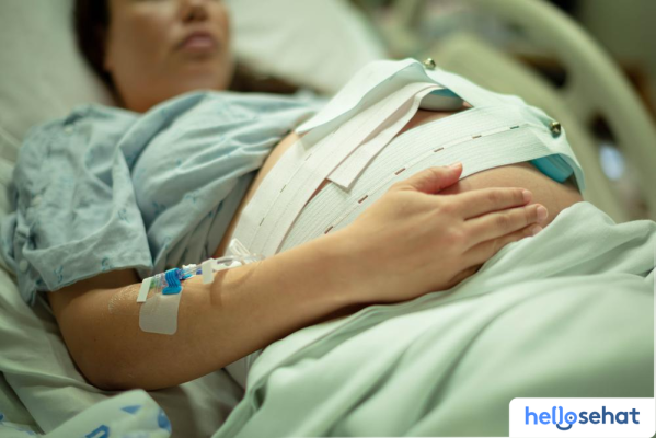 Foley Bulb Induction, Prosedur untuk Mempercepat Persalinan | Hello Sehat