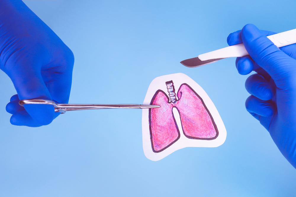 Artikel Kesehatan Penyakit Emfisema | Hello Sehat