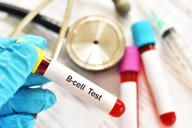 Flow Cytometry: Definisi, Proses, dan Risiko Komplikasi • Hello Sehat