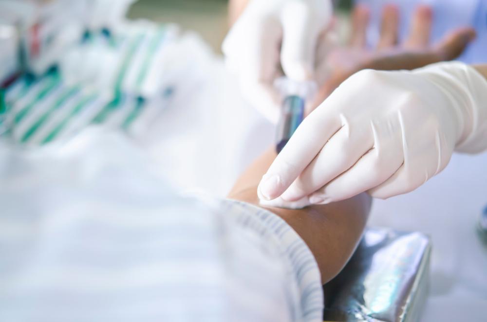 Pemeriksaan TPHA, Skrining untuk Deteksi Penyakit Sifilis | Hello Sehat