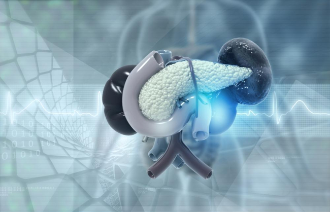 Mengenal Perbedaan Jenis Kanker Pankreas Hello Sehat