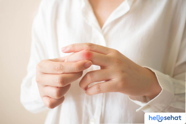 Digital Sclerosis, Komplikasi Diabetes pada Kulit Jari - Hello Sehat